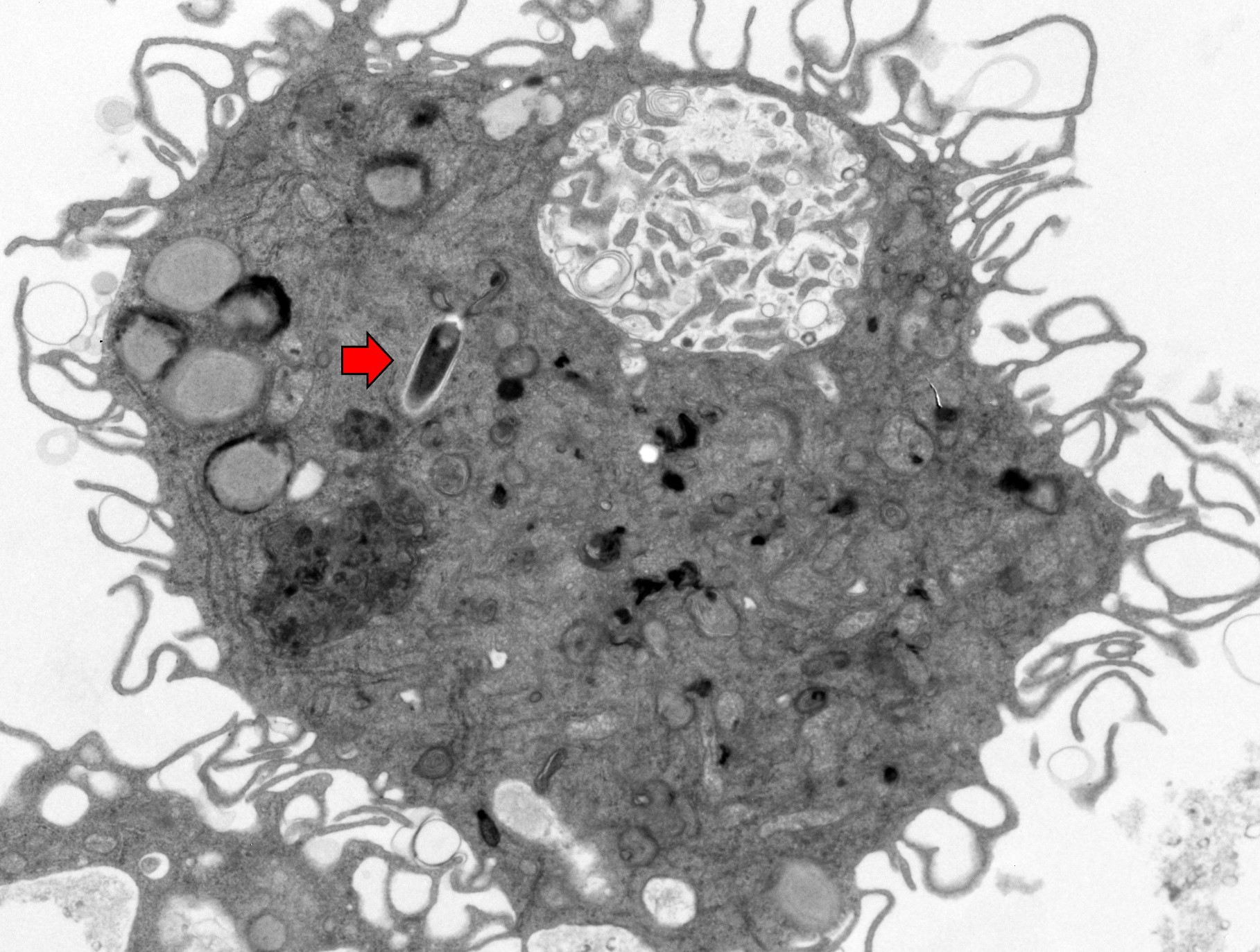 Radical Roadmap Russell Lab Develops Novel Technique To Analyze The Host Pathogen Dynamic